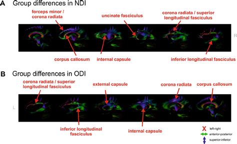 Sagittal Colour Coded Maps Of The Mean Diffusion Tensor Image Red Download Scientific Diagram
