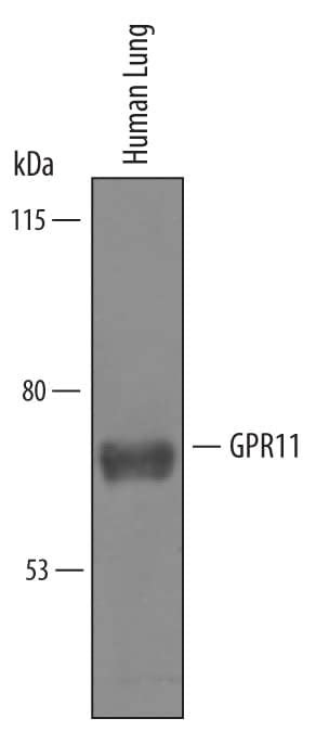 Human GPR111 Antibody AF6494: R&D Systems
