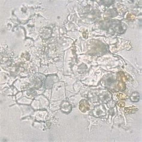 Function Of Palisade Cells Plants At William Chaffin Blog