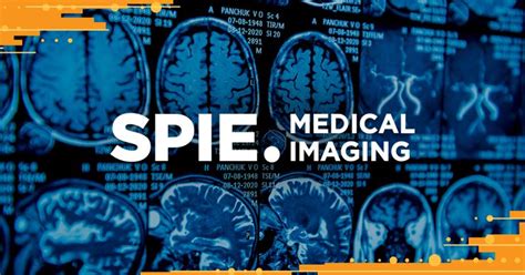 Imane Chafi On Linkedin 3d Generation Of Dental Crown Bottoms Using