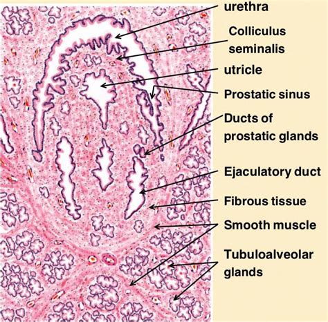 Prostatic Utricle Histology