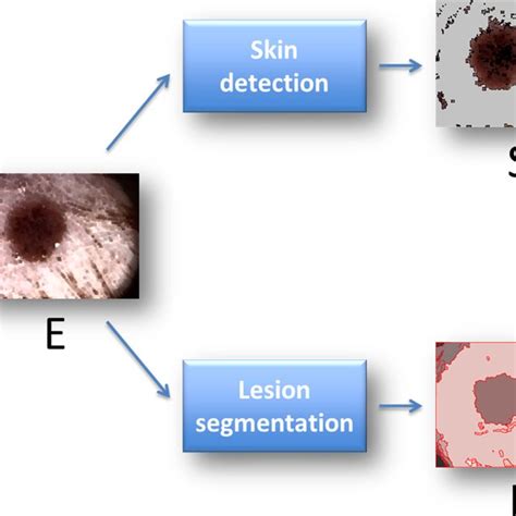 Skin Lesion Segmentation A Dermoscopic Image In Input B Binary Mask