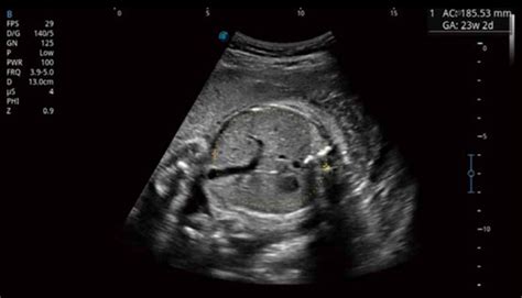 Sonoscape P9 Elite Sonoscape Spain