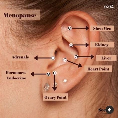 Pin By Carol Song On Ear Acupuncture In 2024 Acupuncture Ear