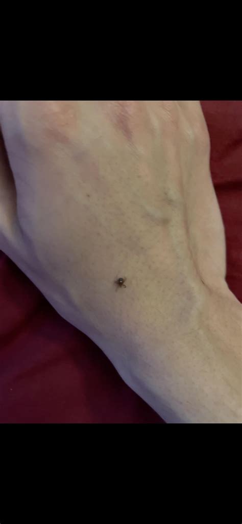What Is This It Doesnt Look Like A Bed Bug But I Have No Idea R Whatsthisbug