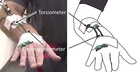 Figure 3 From Wrist Posture Estimation Differences And Reliability Between Video Analysis And