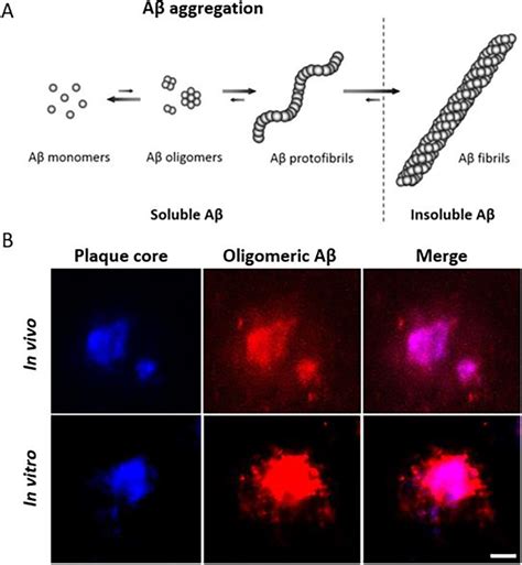 Aggregation Of Aβ A The Aβ Peptide Misfolds And Aggregates Into Download Scientific Diagram