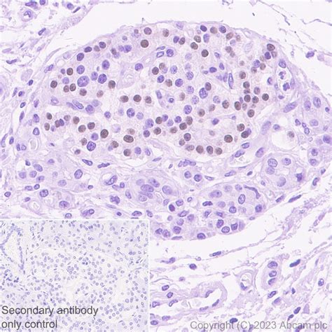 Arx重组抗体 Epr27481 32 Arx抗体ab308260 Abcam中文官网 Arx重组抗体 Epr27481 32 Arx抗体ab308260 Abcam中文官网