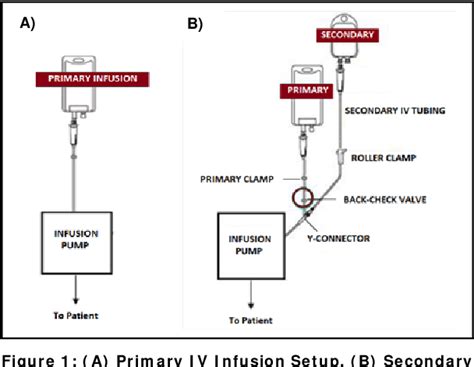 What Are The Differences Between Primary And Secondary Iv 60 Off