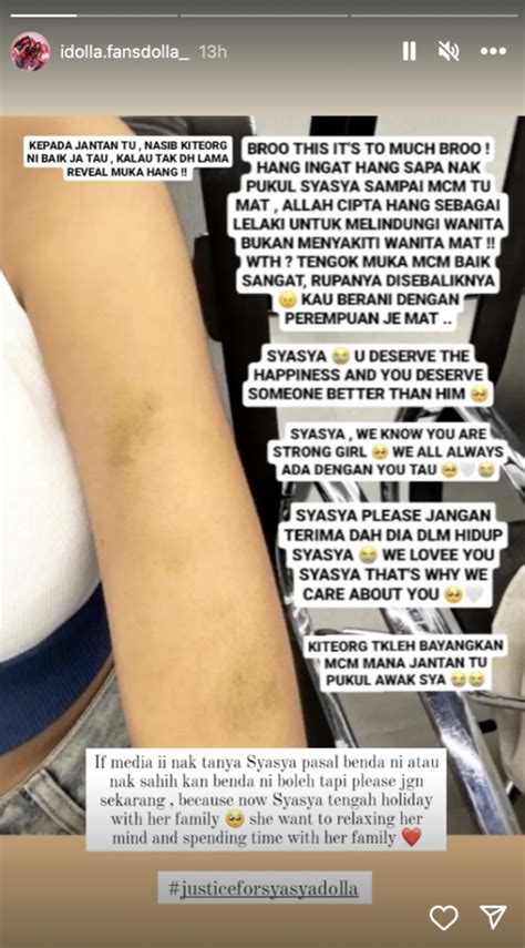 Tangan Syasya Dolla Lebam Dipukul Kekasih Ohbulan