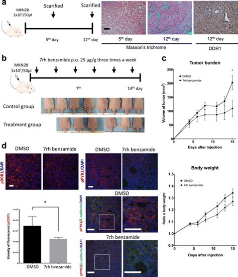 Pharmacologic Inhibition Of Ddr1 Reduces Gastric Cancer Tumor Growth A
