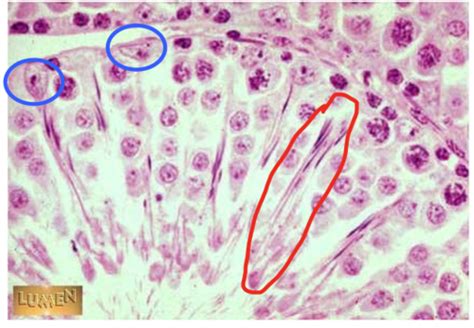 Labeled Epididymis Microscope Slide