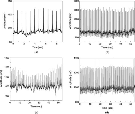 Mit Bih Ecg Signals At A Rest B Walk C Jog D Exercise Download Scientific Diagram