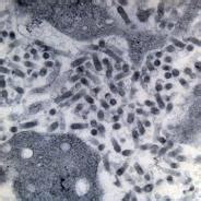Infectious Hematopoietic Necrosis Virus Ihn Fish Pathogens