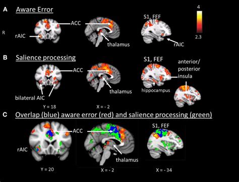 a aware error statistical parametrical map of difference in bold