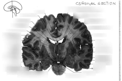Coronal Section 2 Diagram Quizlet