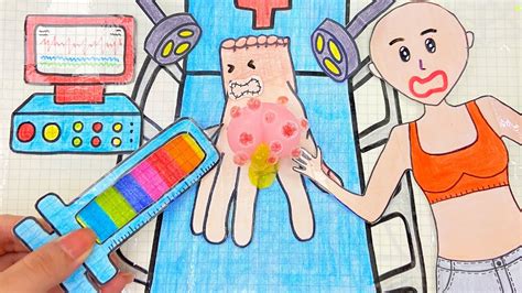 Paperdiy POP THE PIMPLES 2 Baby Wednesday Care Tips Paper Stories HousePetsCare Com