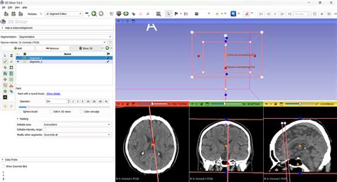 3d view in segmentation rendering does not show anyting support 3d