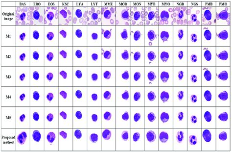 results of 15 different types of wbc segmentation using the proposed