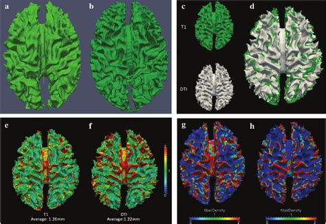 Comparison Of Cortical Surface Reconstruction Approaches A A