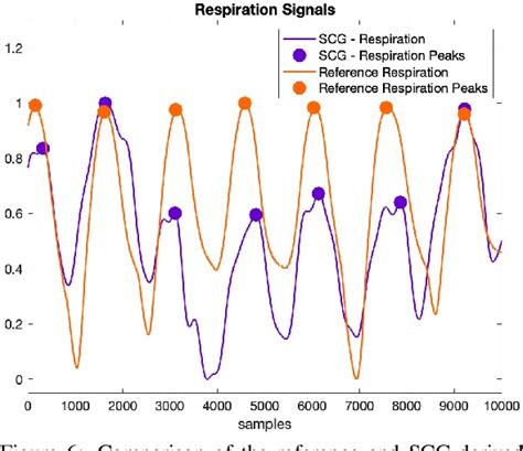 Figure From A Novel Multi Modal Sensing System Prototype For Cardiovascular And
