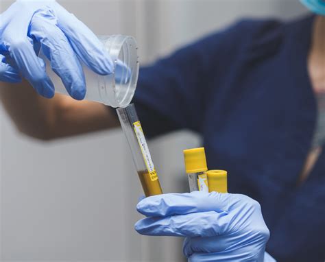 How To Avoid A Negative Dilute On Your Drug Test Fleet Drug Testing