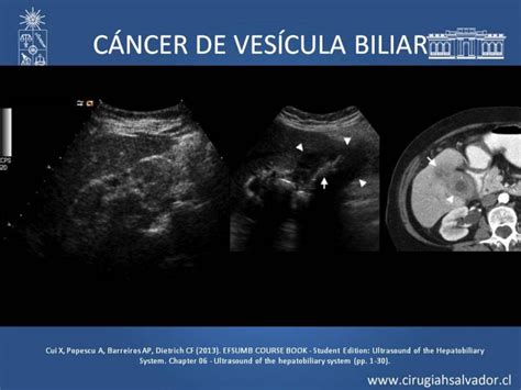 Presentaciones Depto Cirugía Hospital Del Salvador