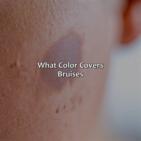 What Color Covers Bruises