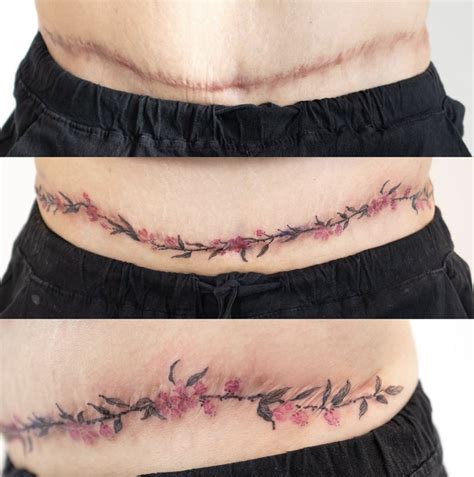 Abdominal Scar Tattoos Meaning Designs And Placement Tips