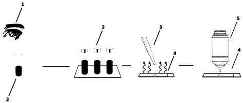 Artificial Intelligence Detection Method Of Keratitis Pathogenic Bacteria Based On Human Tears
