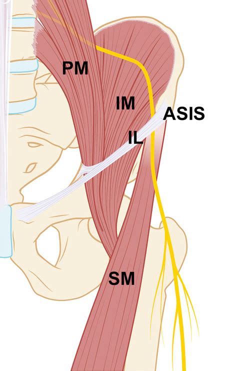 Unusual Causes For Meralgia Paresthetica Systematic Review Of The