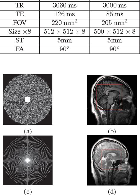 Figure 1 From Partially Parallel Mr Image Reconstruction Using Sensitivity Encoding Semantic