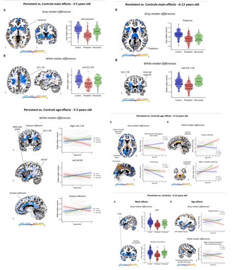 English Teacher Here I Stutter And Have A Class Today Im So Nervous R Stutter