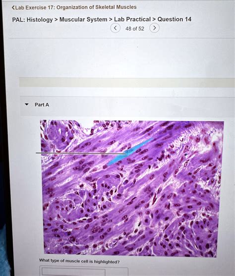 Muscular System Lab Practical Question 14 Part A What Type Of