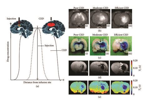 Theoretical And Experimental Considerations Of CED For Effective Drug Download Scientific