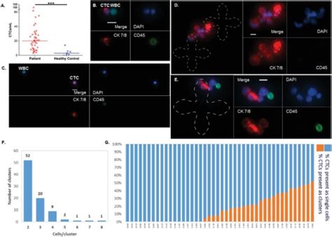 Detection Of Ctc Clusters And A Dedifferentiated Rna‐expression