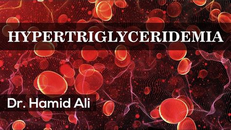 Hypertriglyceridemia Treatment Dr Hamid Ali Youtube