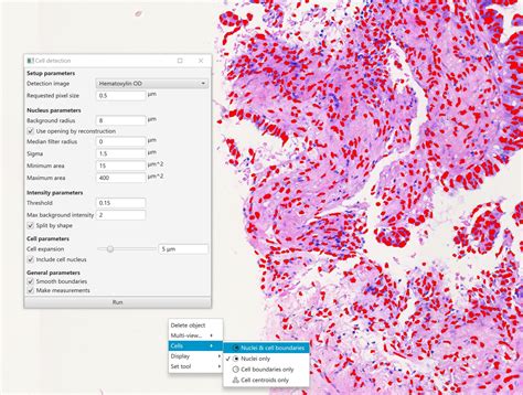 Seeking Solutions Enhancing Cell Detection Accuracy On Wsi Images Using Qupath Or Alternative