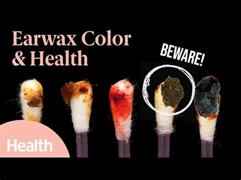 What Does It Mean When Your Ear Wax Is Liquidy