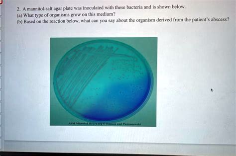 Solved A Mannitol Salt Agar Plate Was Inoculated With These Bacteria And Is Shown Below What