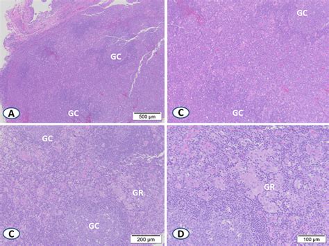 Selected Hande Sections Of Typical Lymph Node Architecture In Acute Ebv Download Scientific
