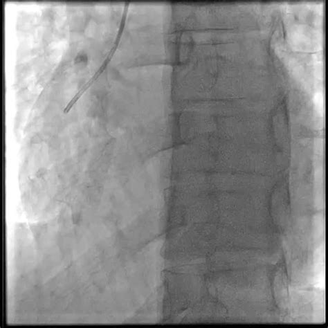 Pavel Somov On Linkedin Dissection 51 Comments