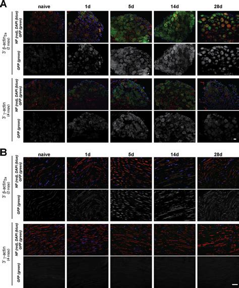 Tα1 Gfp 3β Actin But Not Tα1 Gfp 3γ Actin Mice Show Gfp In Pns Axons Download Scientific