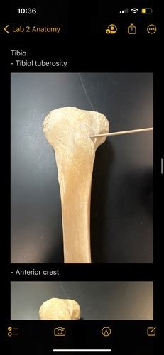 Tibia Flashcards Quizlet