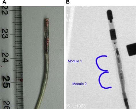 Magnetic Resonance Guided Active Catheter Tracking Radiology Key