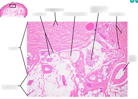 Bio 201 Thick Skin Dermis And Hypodermis Logitudinal Section