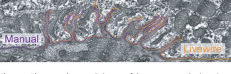 figure 1 from a framework for feedback based segmentation of 3d image