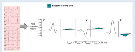 transformation of ecg to vcg and calculation of baseline t wave area
