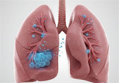 Lungs Oxygen Diffusion Stock Illustration Illustration Of Orange 372711145