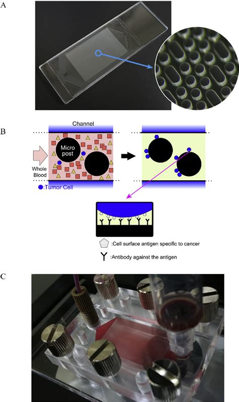 Figure 1 From Initial Detection Of Circulating Tumor Cells From Metastatic Prostate Cancer